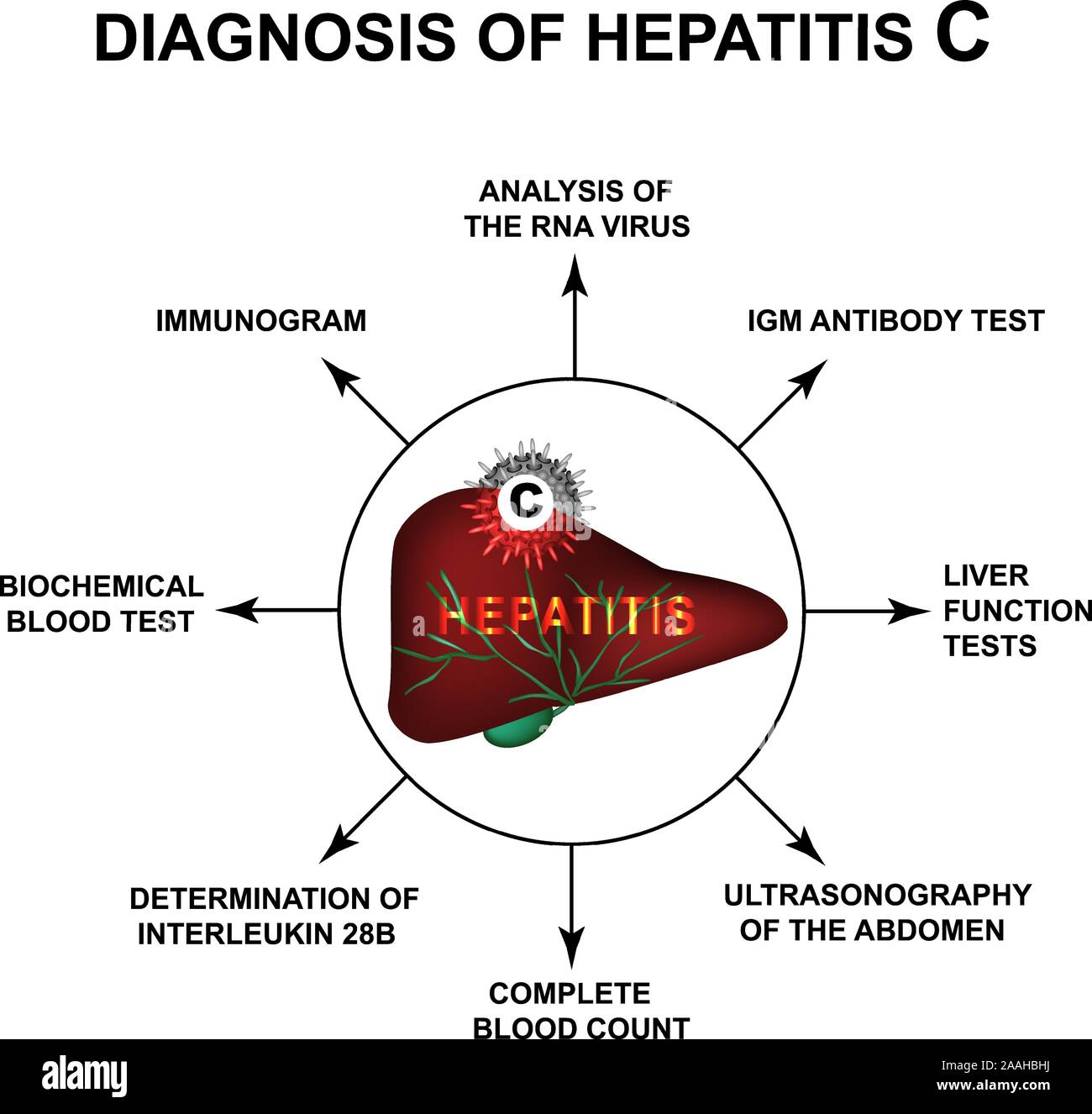 Diagnosis of hepatitis C. World Hepatitis Day. Infographics. Vector illustration on isolated ...