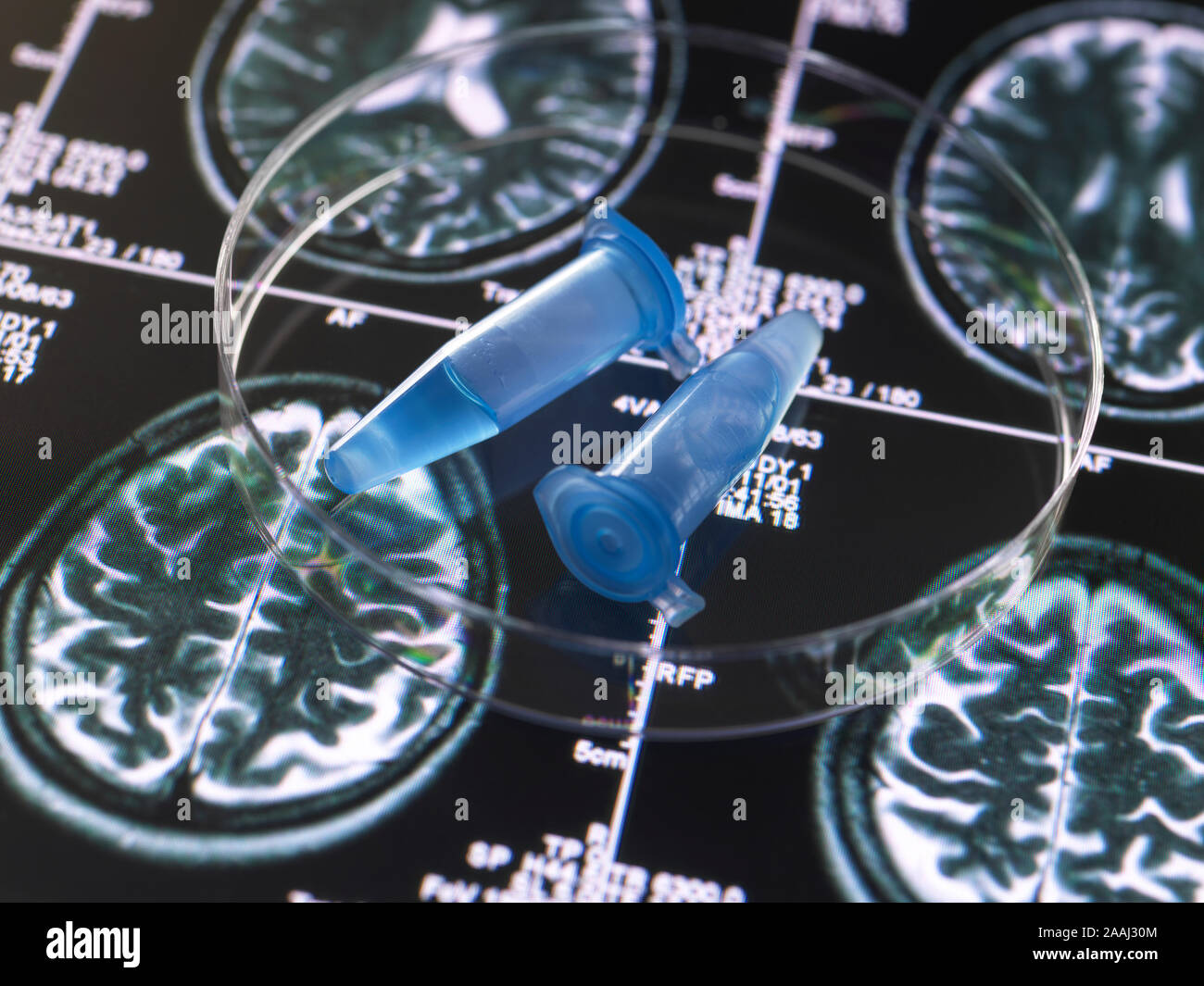 Clinical samples from research project contained in vials with brain ...