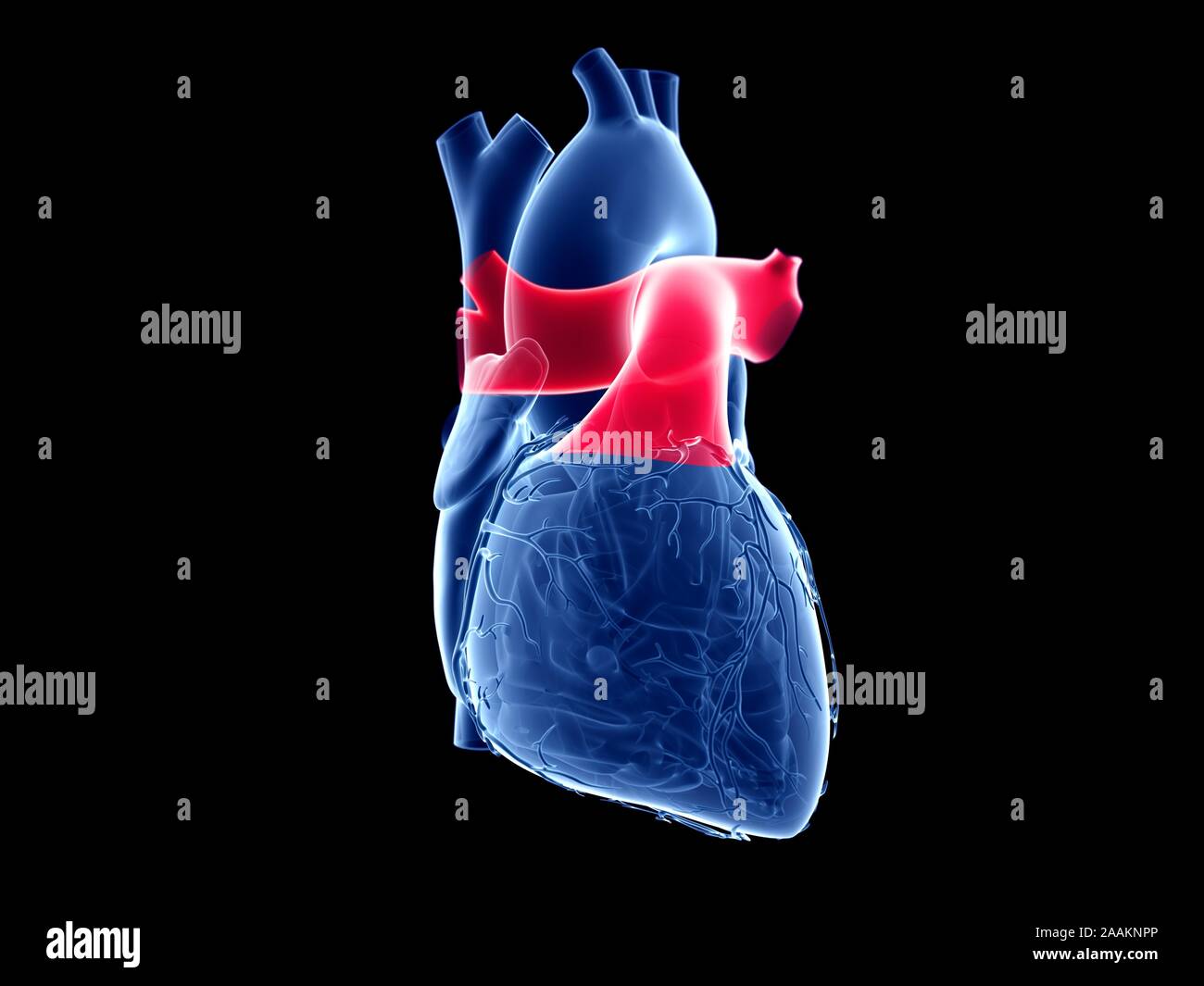 Pulmonary trunk hi-res stock photography and images - Alamy
