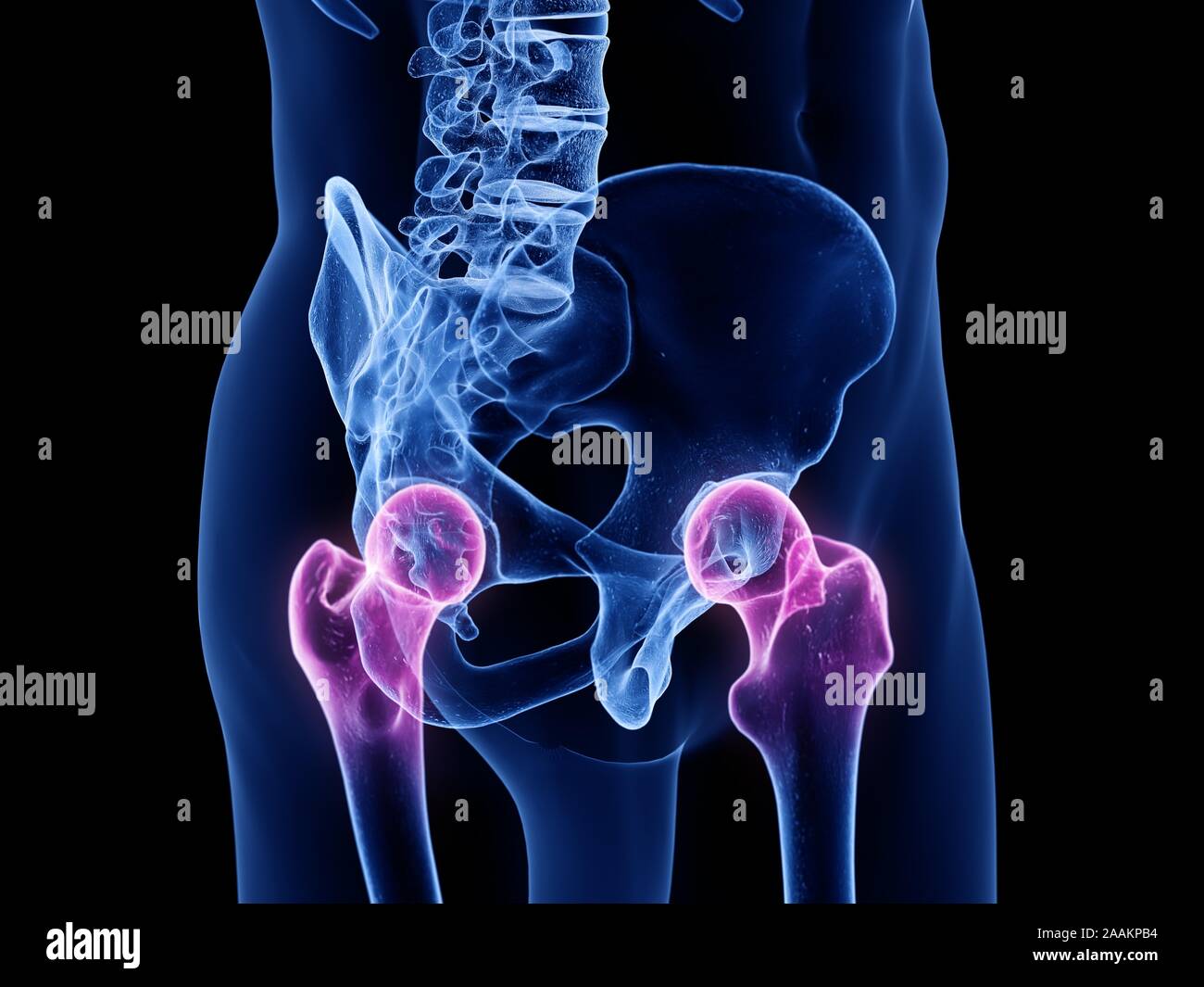 Hip joints, computer illustration Stock Photo - Alamy