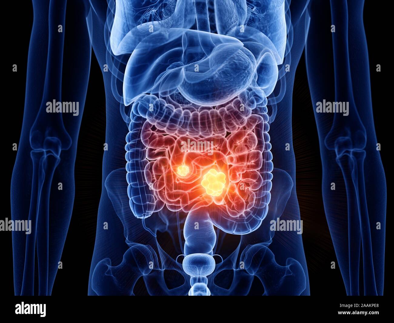 Duodenum disorder hi-res stock photography and images - Alamy