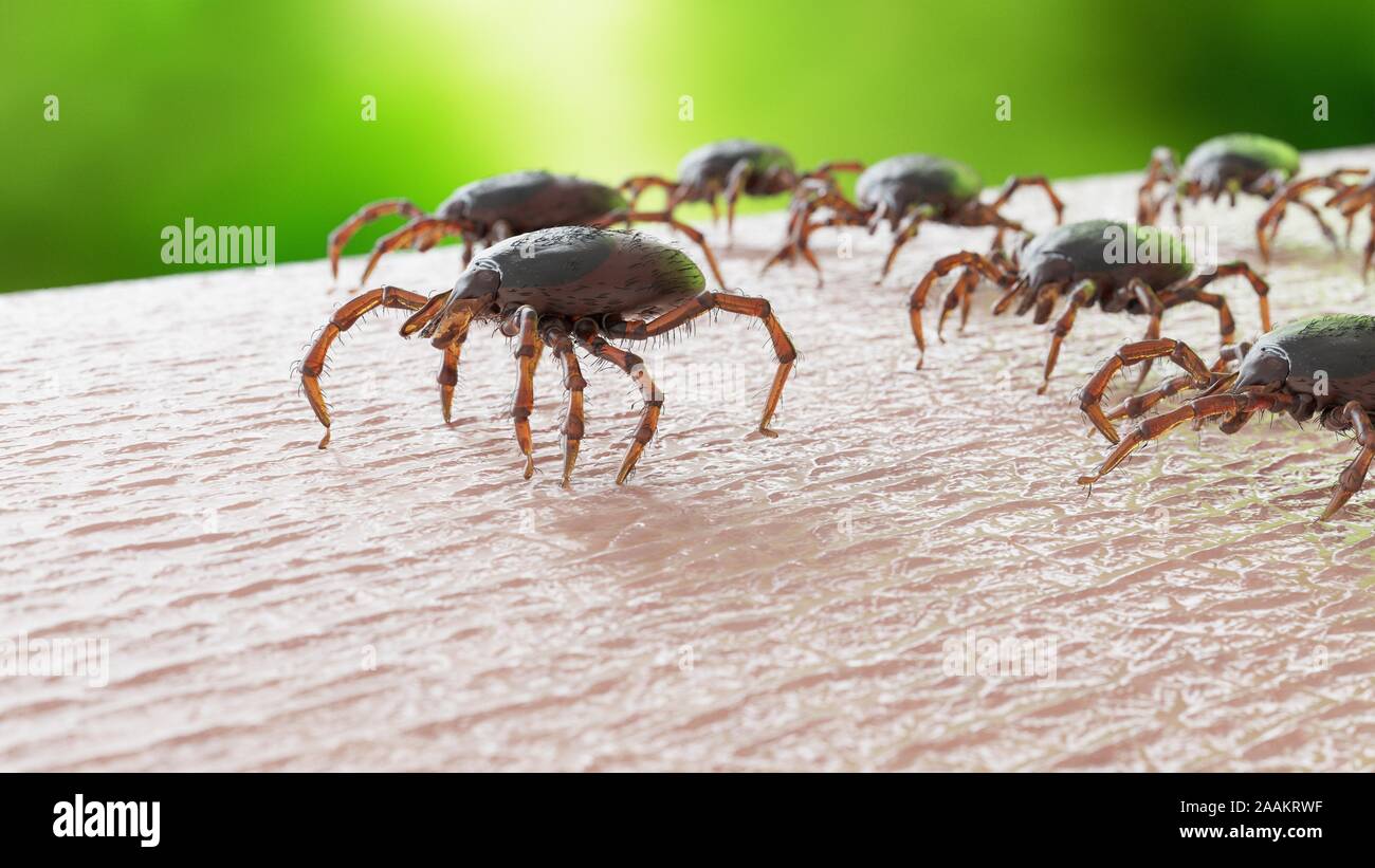 Ticks on human skin, computer illustration Stock Photo - Alamy