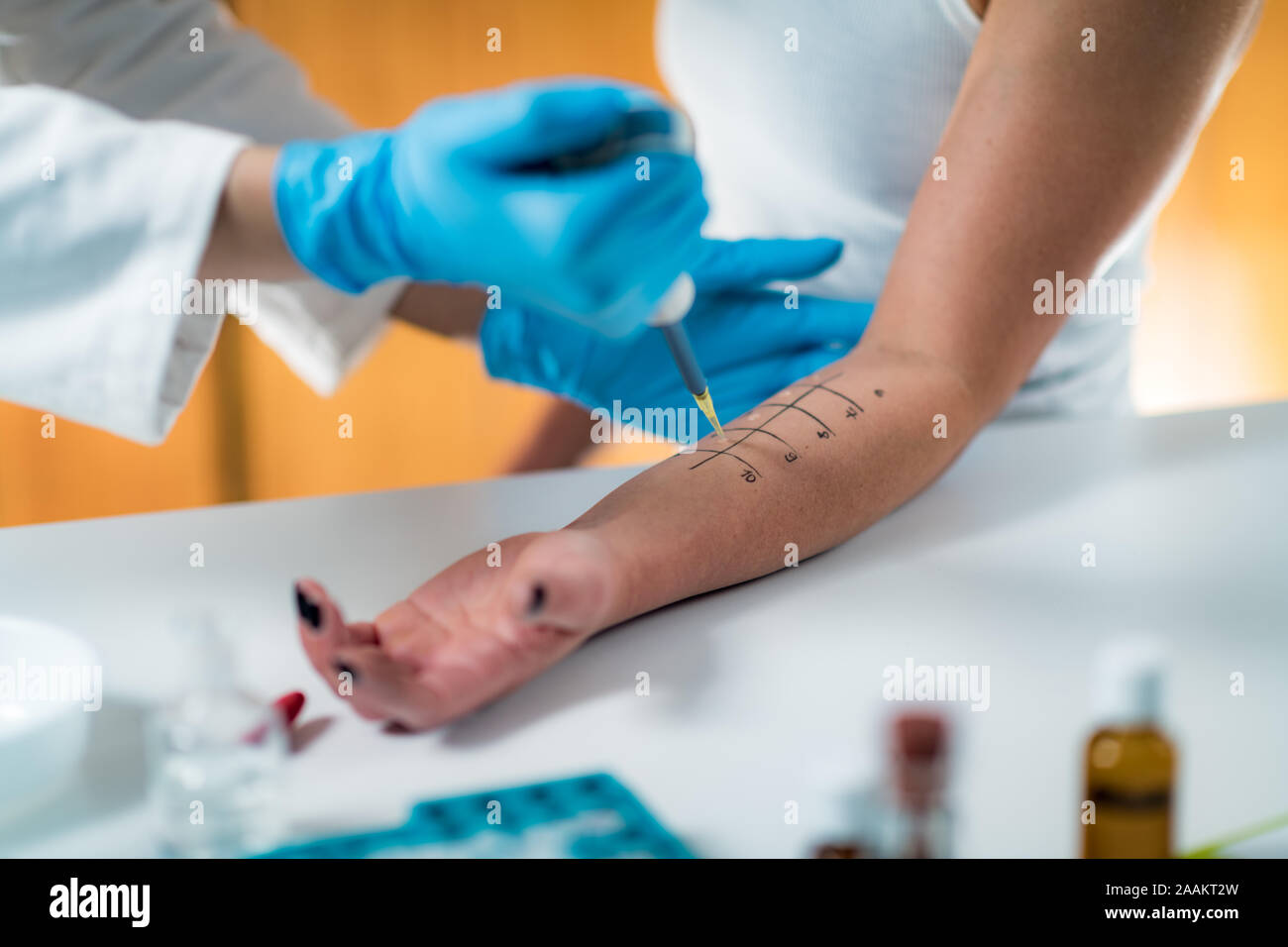 Immunologist testing allergy reaction on a woman's arm Stock Photo - Alamy