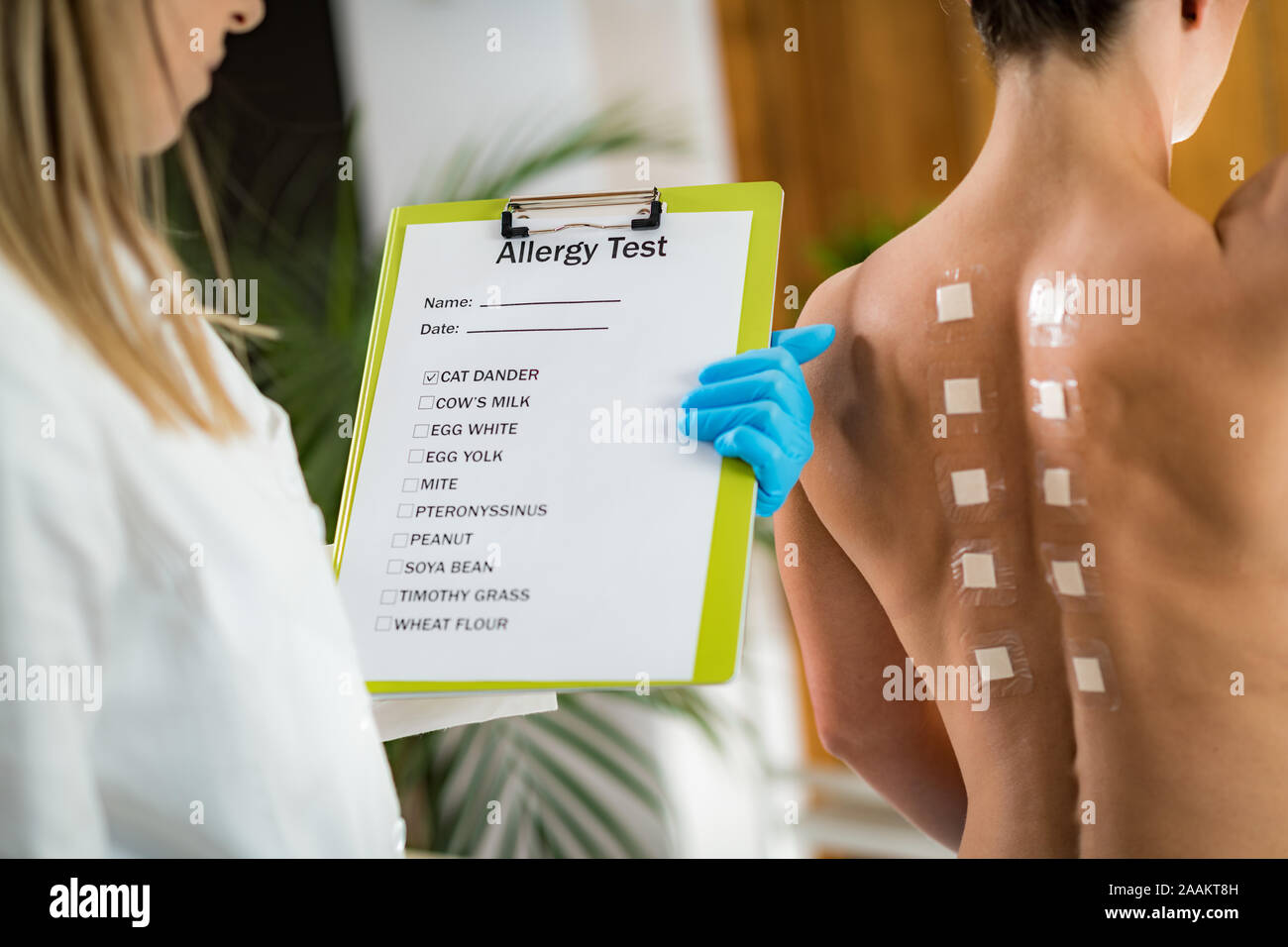 Immunologist doing skin prick allergy test on a woman's back Stock ...