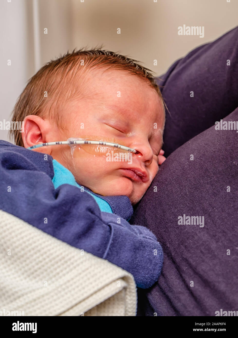 Child with feeding tube hi-res stock photography and images - Alamy