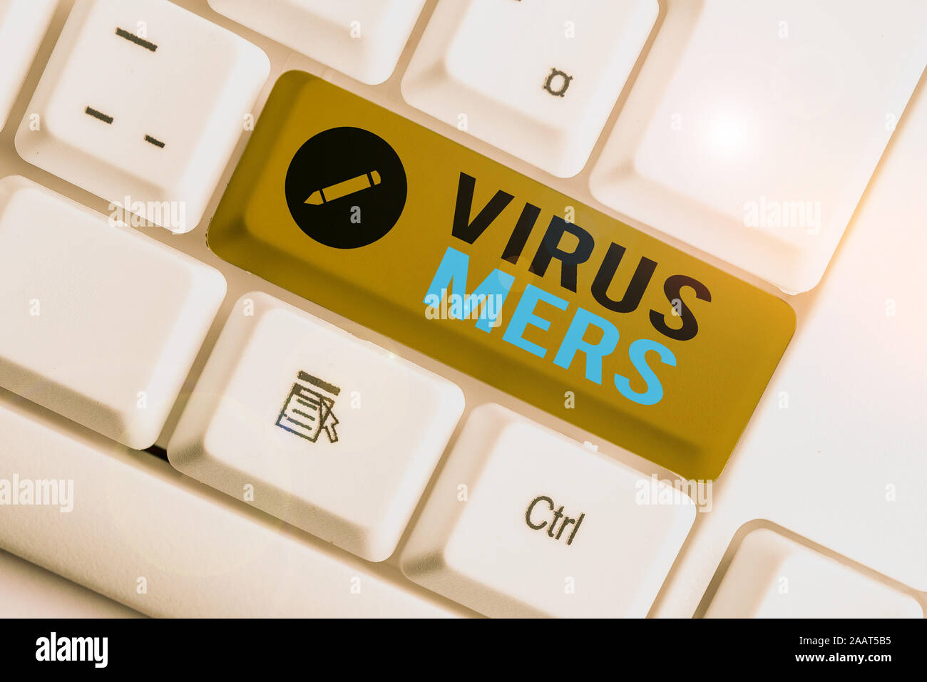 Conceptual hand writing showing Virus Mers. Concept meaning viral ...