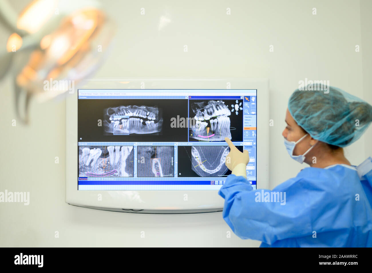 Dentist surgeon showing implant radiography Stock Photo - Alamy
