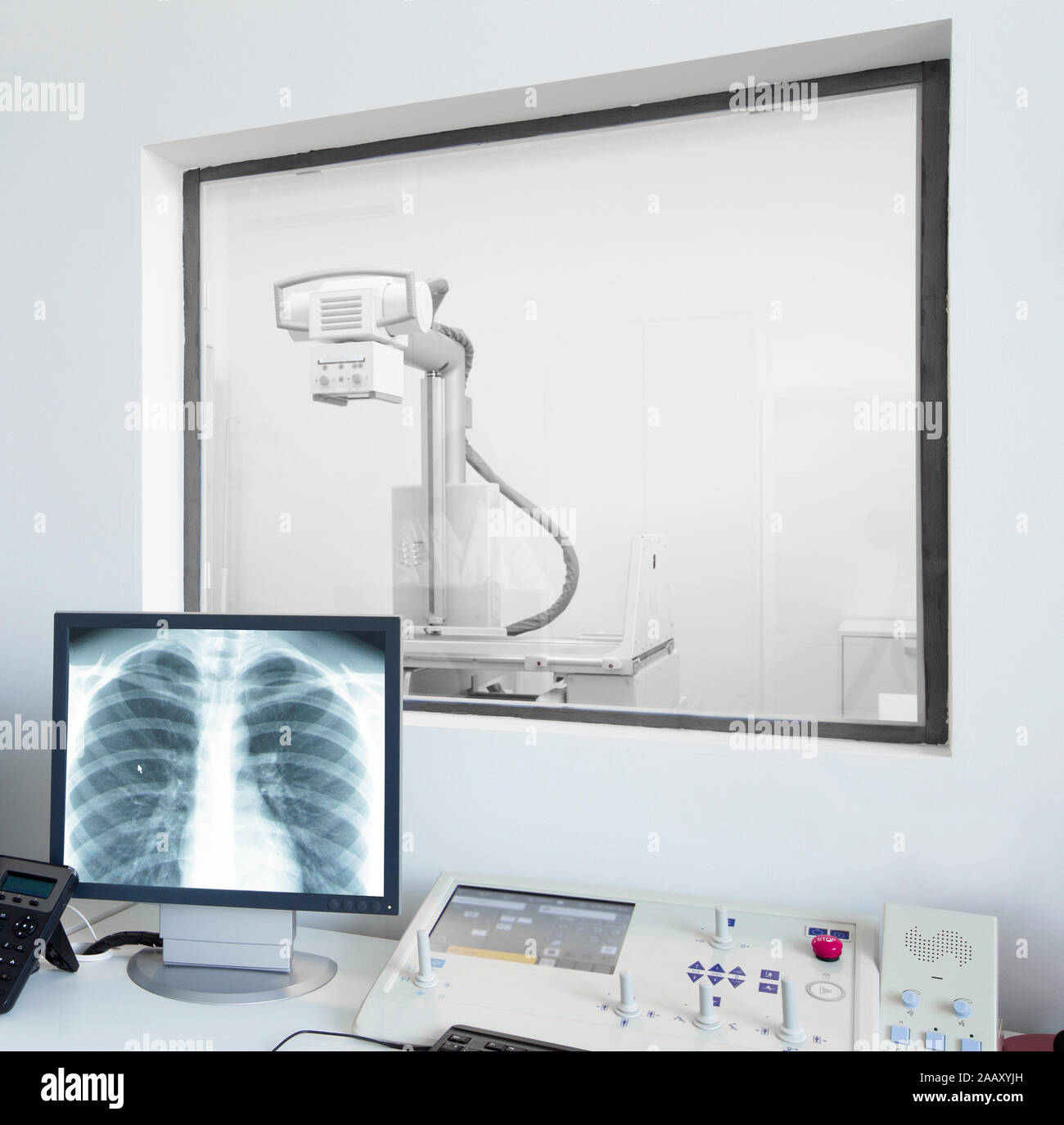 Chest x ray computer hi-res stock photography and images - Alamy