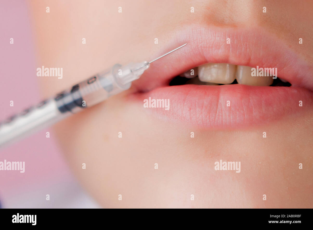 Doctor in gloves giving woman botox injections in lips, on pink ...