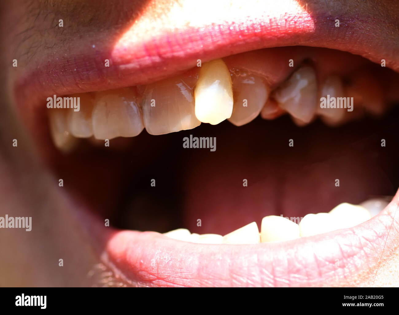 Dentist in scary hi-res stock photography and images - Alamy