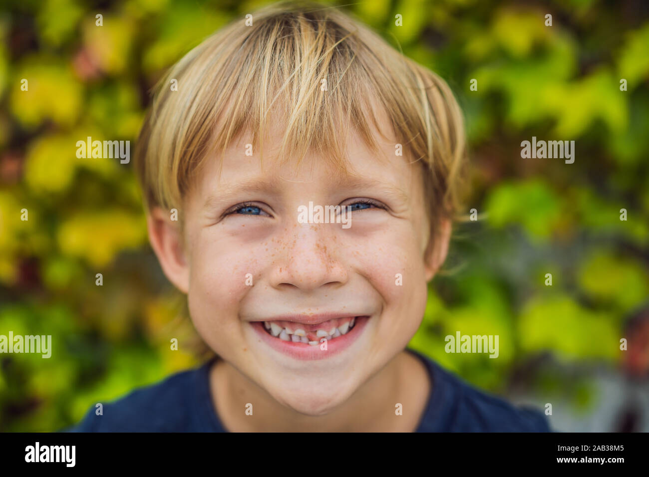 Baby teeth fall out hi-res stock photography and images - Alamy