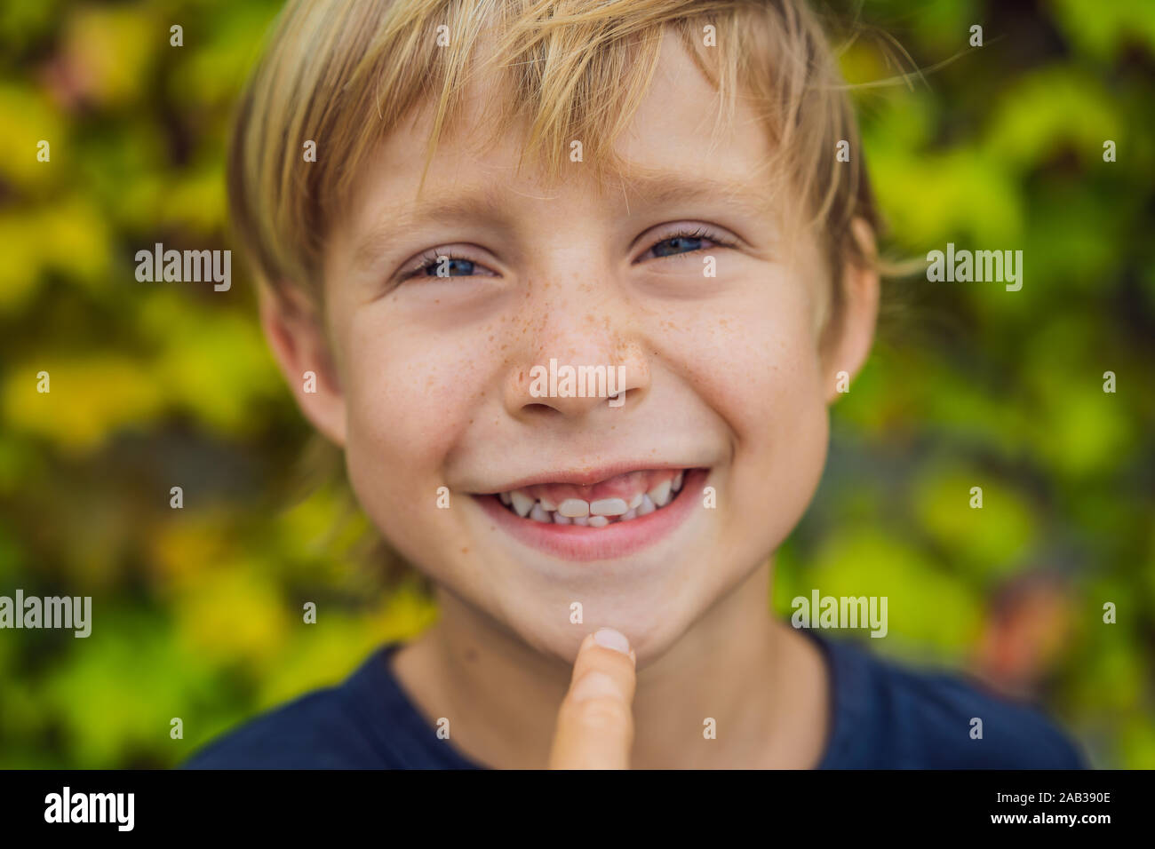 Baby teeth fall out hi-res stock photography and images - Alamy