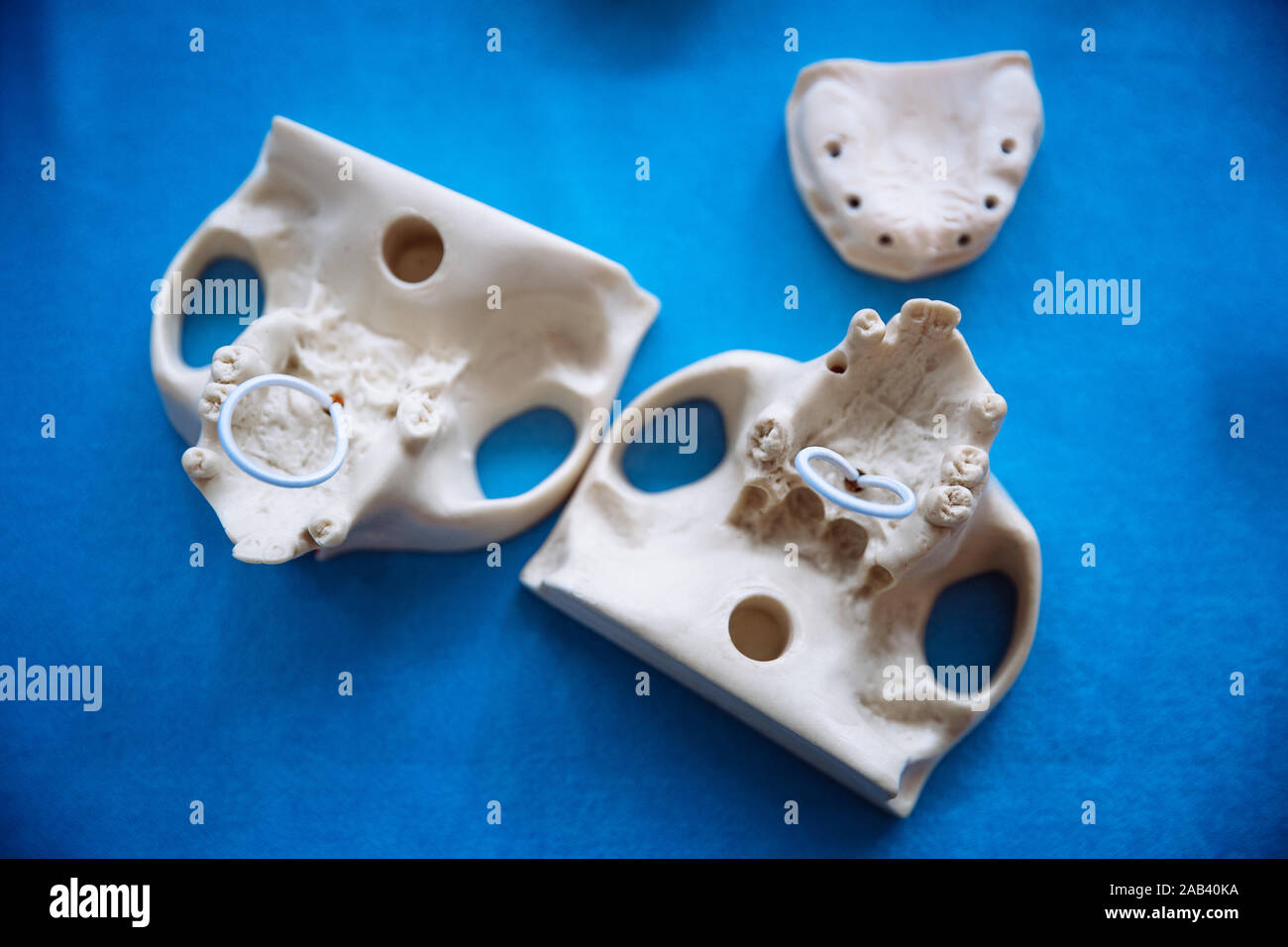 A plastic model of the jaw for prosthetics lies on the table. On a blue ...