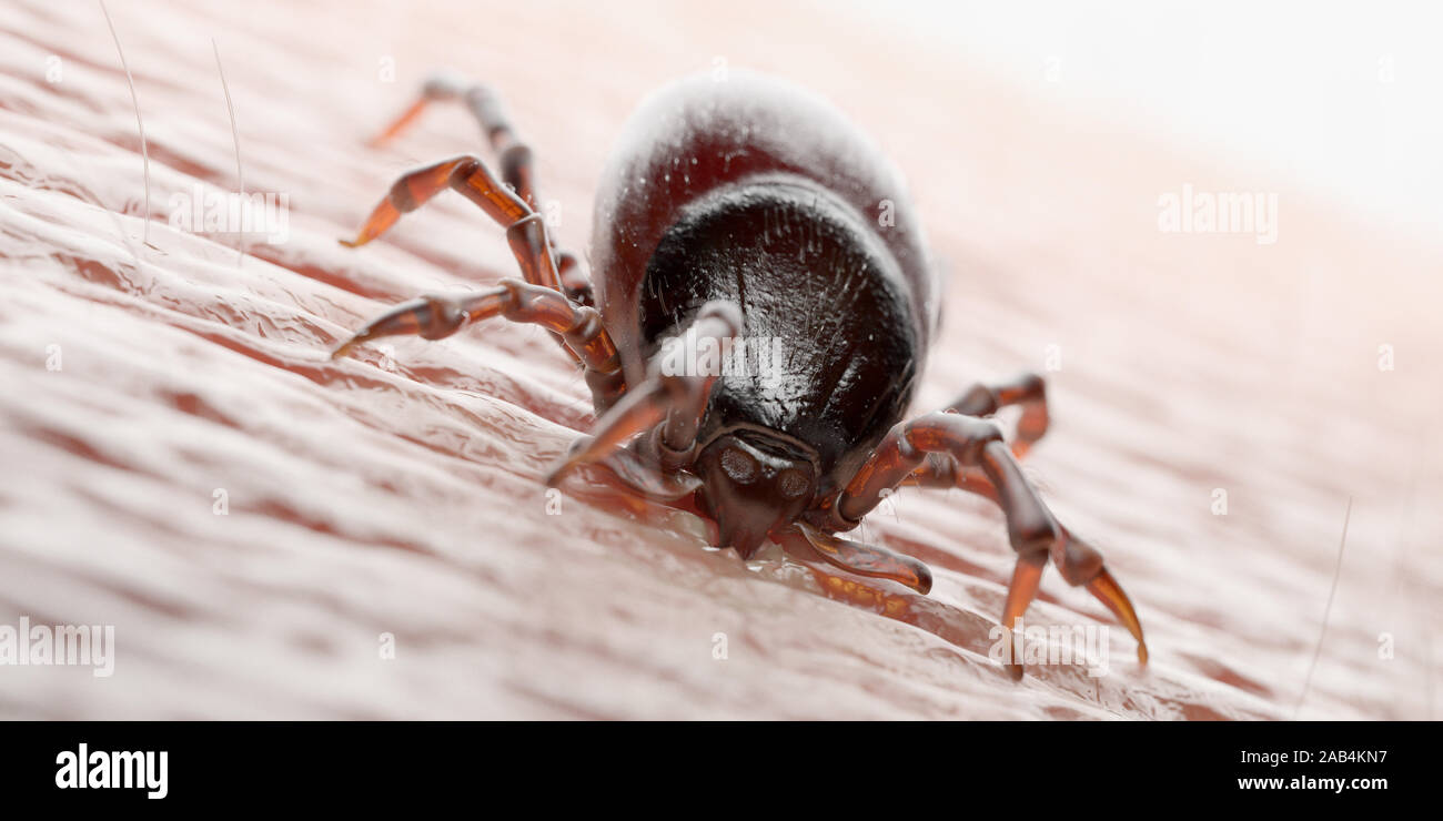 3d rendered illustration of a tick biting in human skin Stock Photo - Alamy