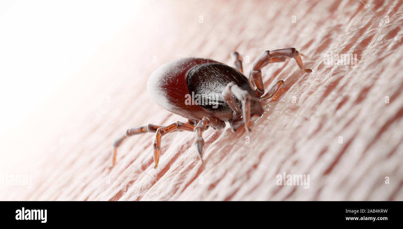 3d rendered illustration of a tick biting in human skin Stock Photo - Alamy