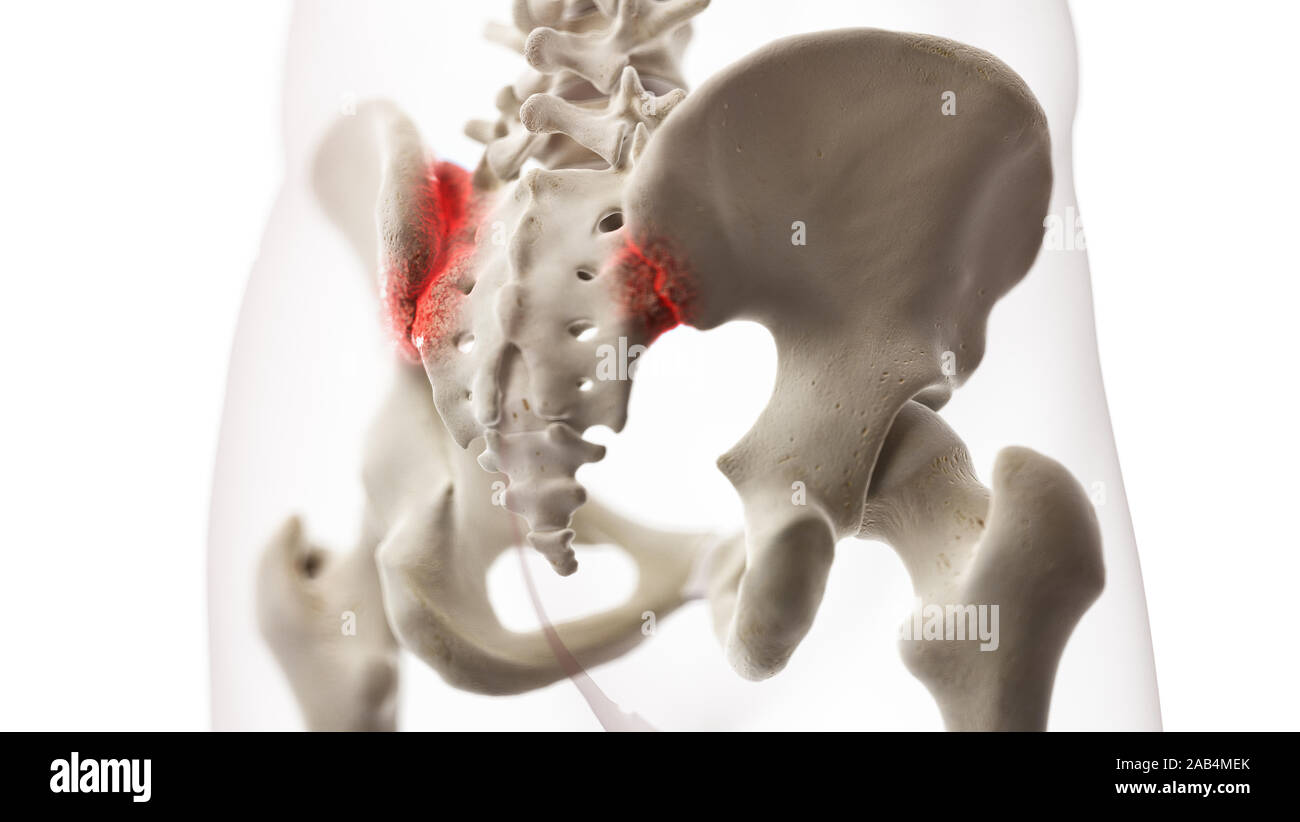 Painful sacroiliac joint hi-res stock photography and images - Alamy