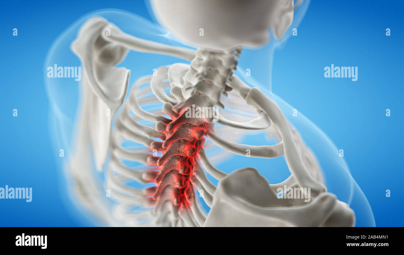 Human thoracic spine pain hi-res stock photography and images - Alamy