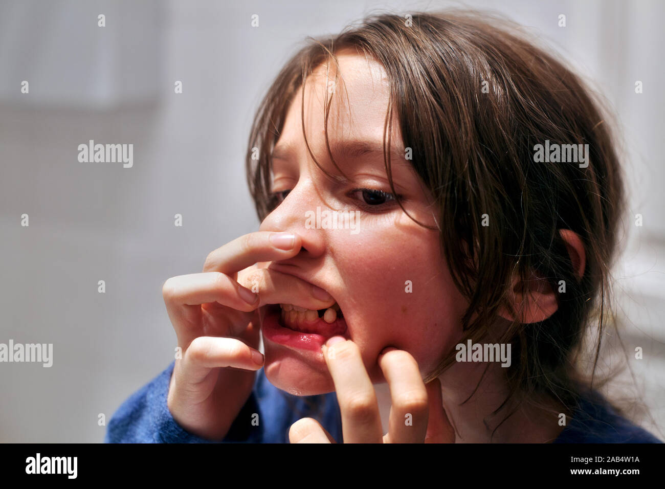 Wobbly tooth hi-res stock photography and images - Alamy