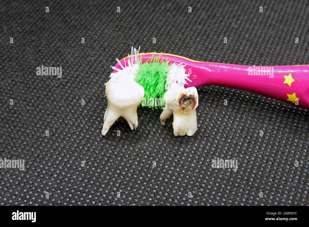 Bad tooth and toothbrush. Dental hygiene.Rotten tooth and toothbrush ...