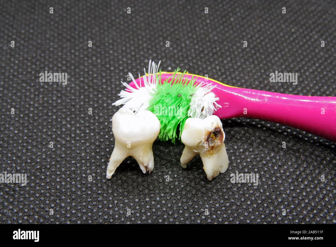 Rotten extracted teeth hi-res stock photography and images - Alamy