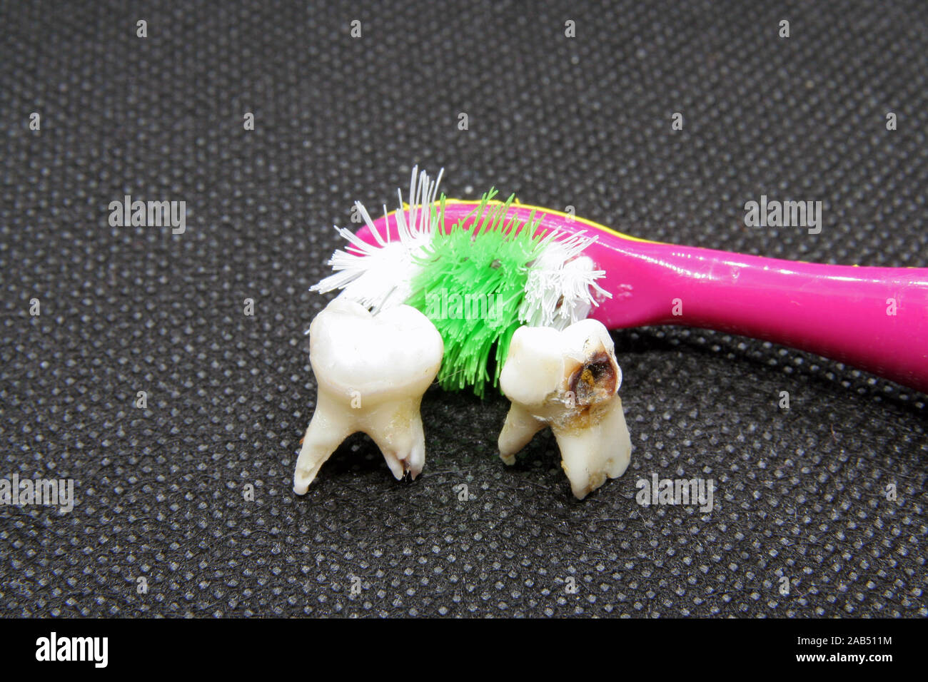 Bad tooth and toothbrush. Dental hygiene.Rotten tooth and toothbrush ...