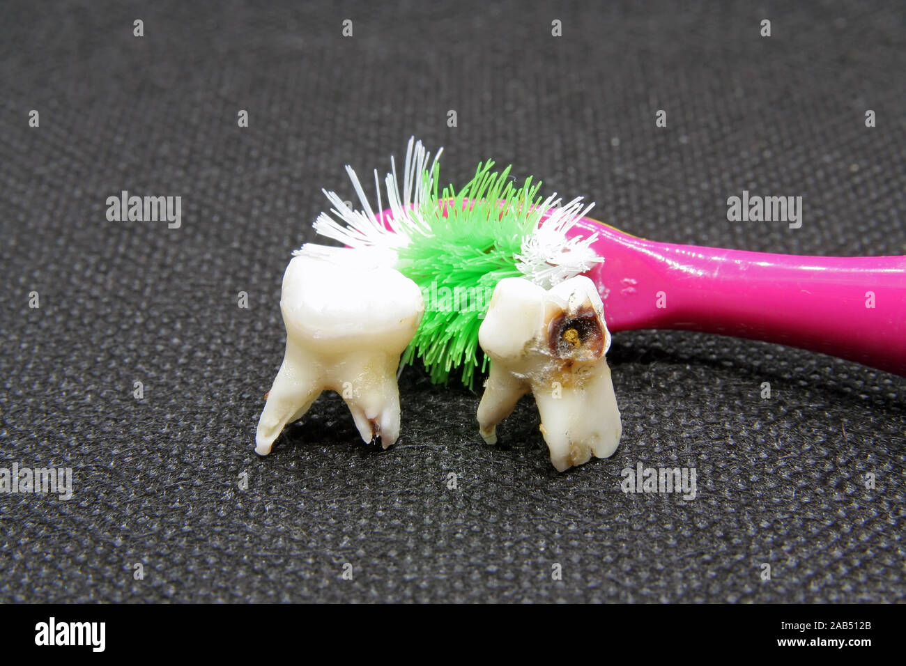 Bad tooth and toothbrush. Dental hygiene.Rotten tooth and toothbrush ...