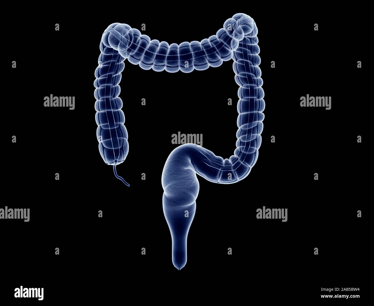 Transverse colon hi-res stock photography and images - Alamy