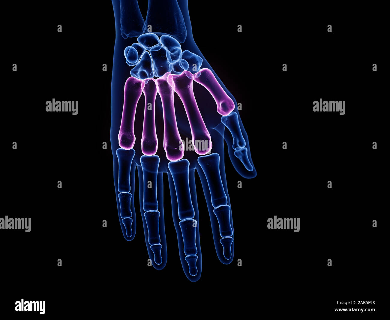 Metacarpal hi-res stock photography and images - Alamy