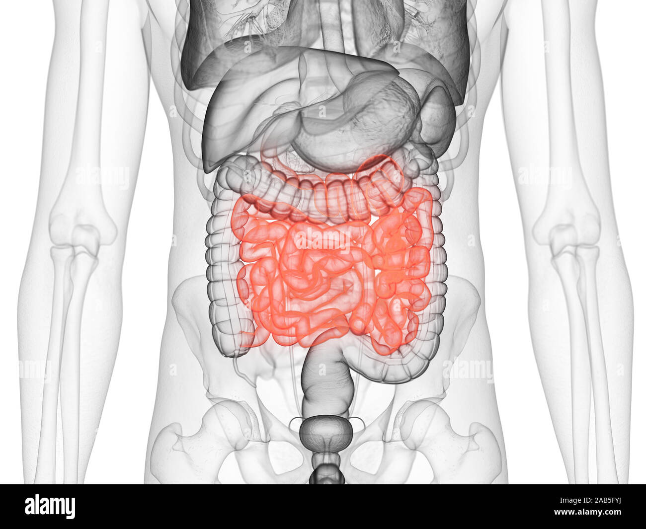 Intestinal Obstruction Stock Photos & Intestinal Obstruction Stock ...