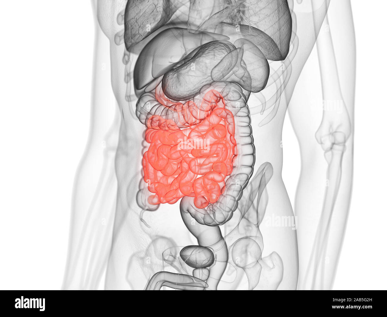 Crohn's Disease Illustration High Resolution Stock Photography and ...