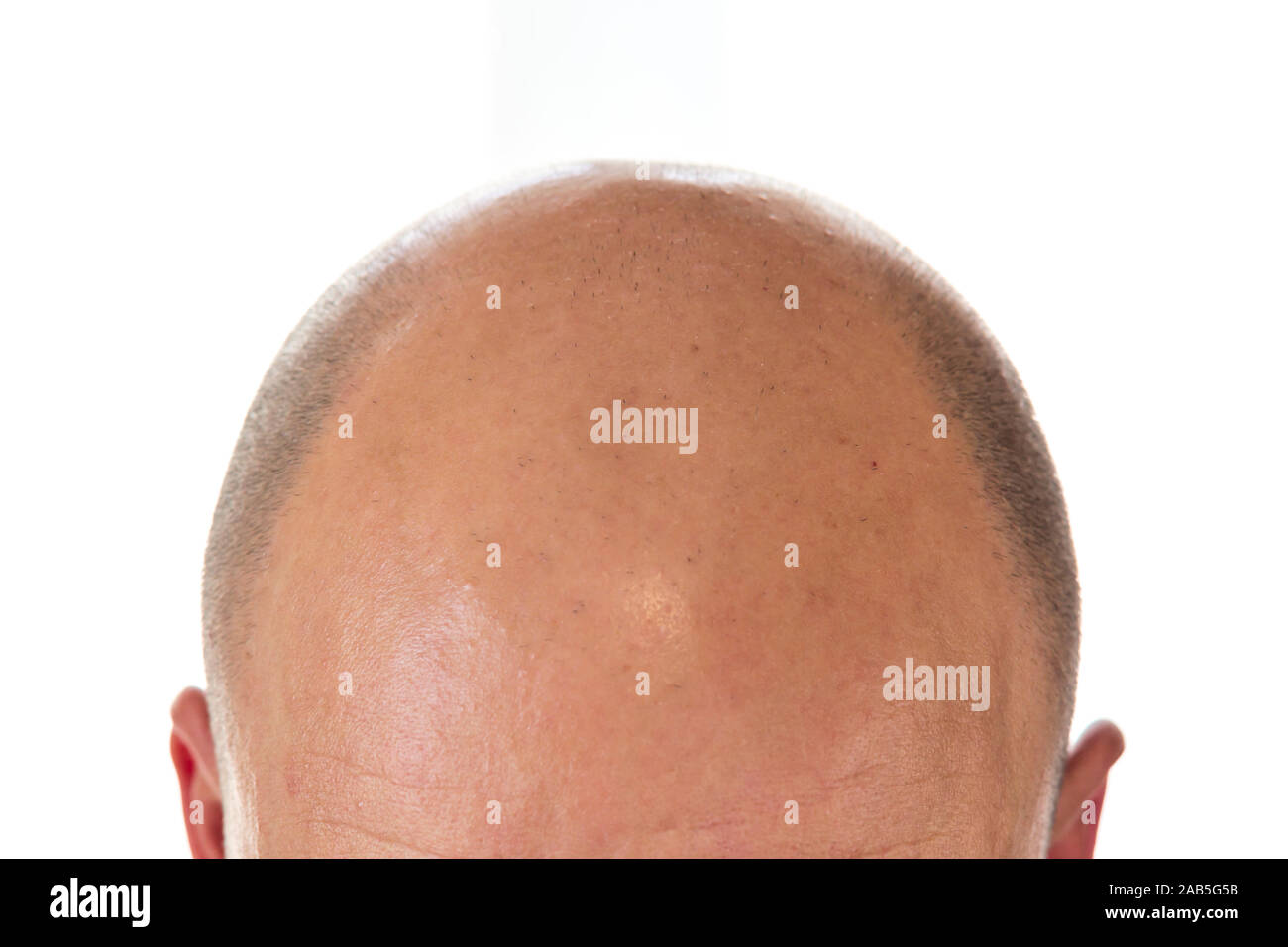 Receding hairline hi-res stock photography and images - Alamy