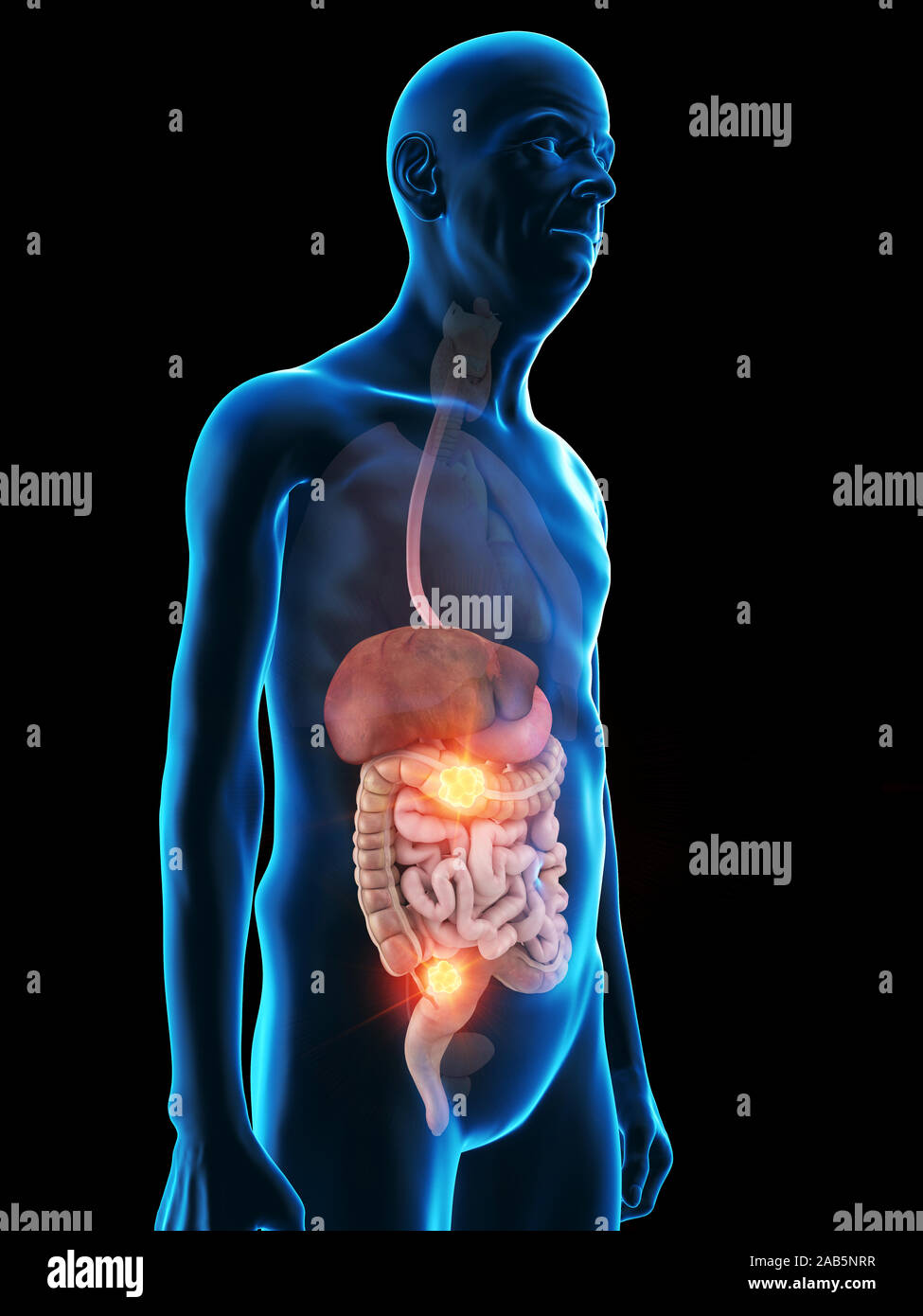 3d rendered medically accurate illustration of an old mans digestive ...