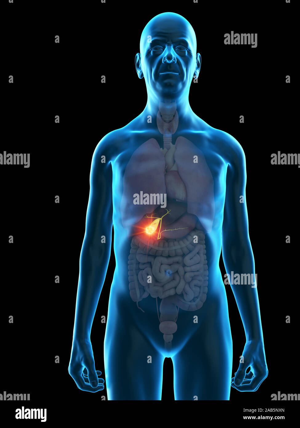 3d rendered medically accurate illustration of an old mans gallbladder ...