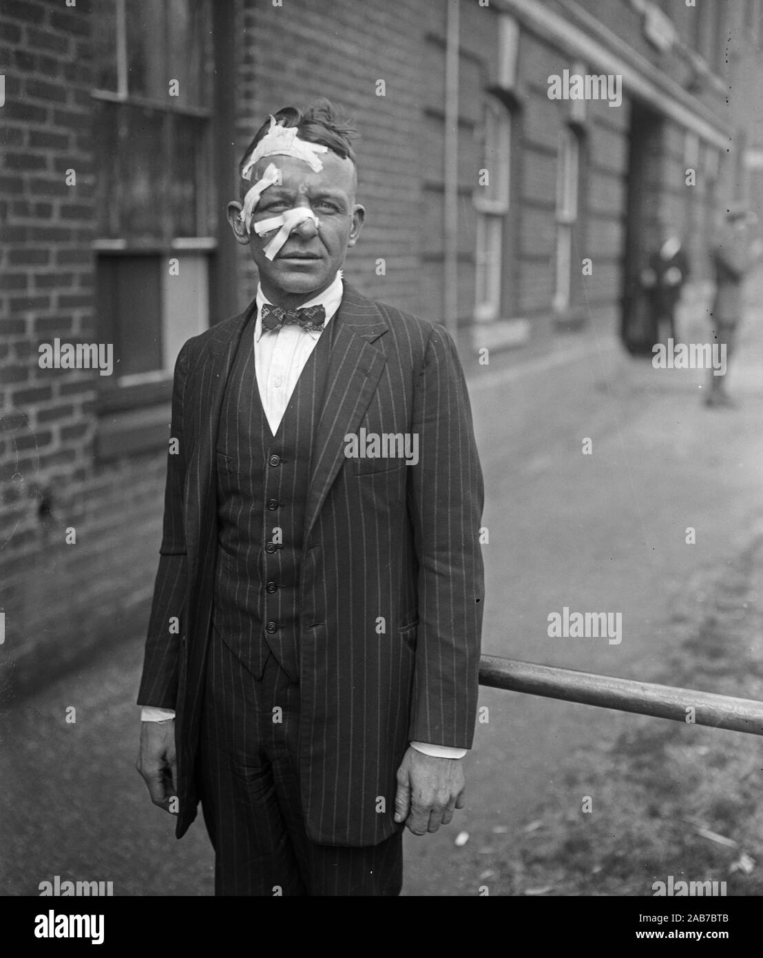 Bandaged face hi-res stock photography and images - Alamy