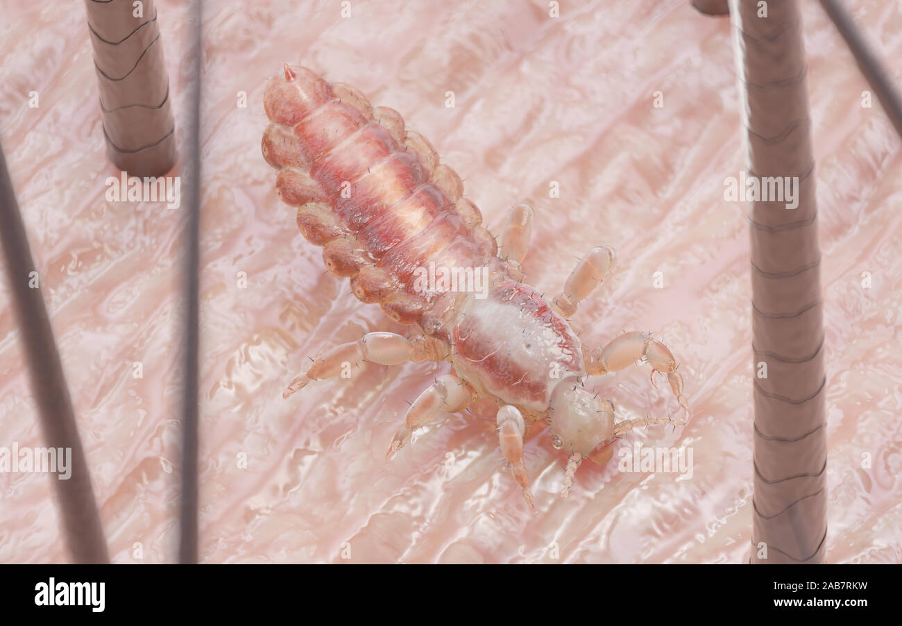 Head louse microscope hi-res stock photography and images - Alamy