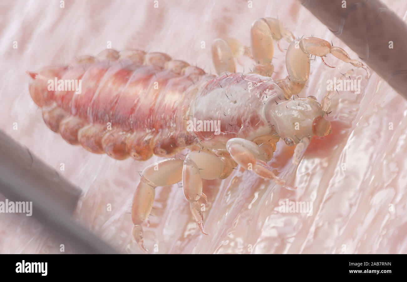 Head louse microscope hi-res stock photography and images - Alamy