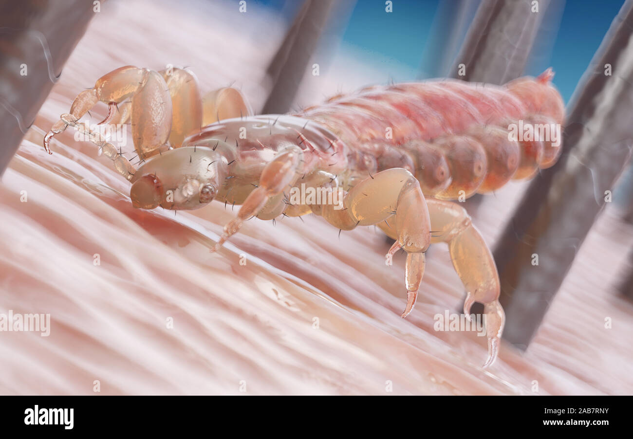 Head louse microscope hi-res stock photography and images - Alamy