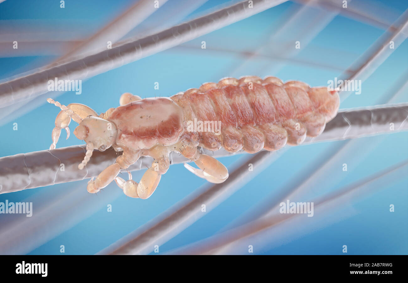 Head louse microscope hi-res stock photography and images - Alamy