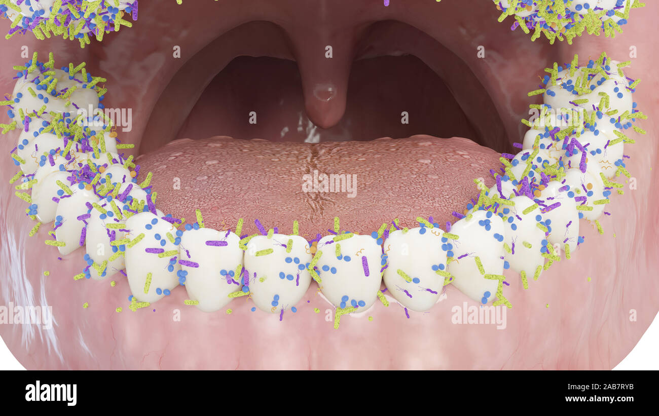 3d rendered conceptual illustration showing the bacteria on the teeth ...