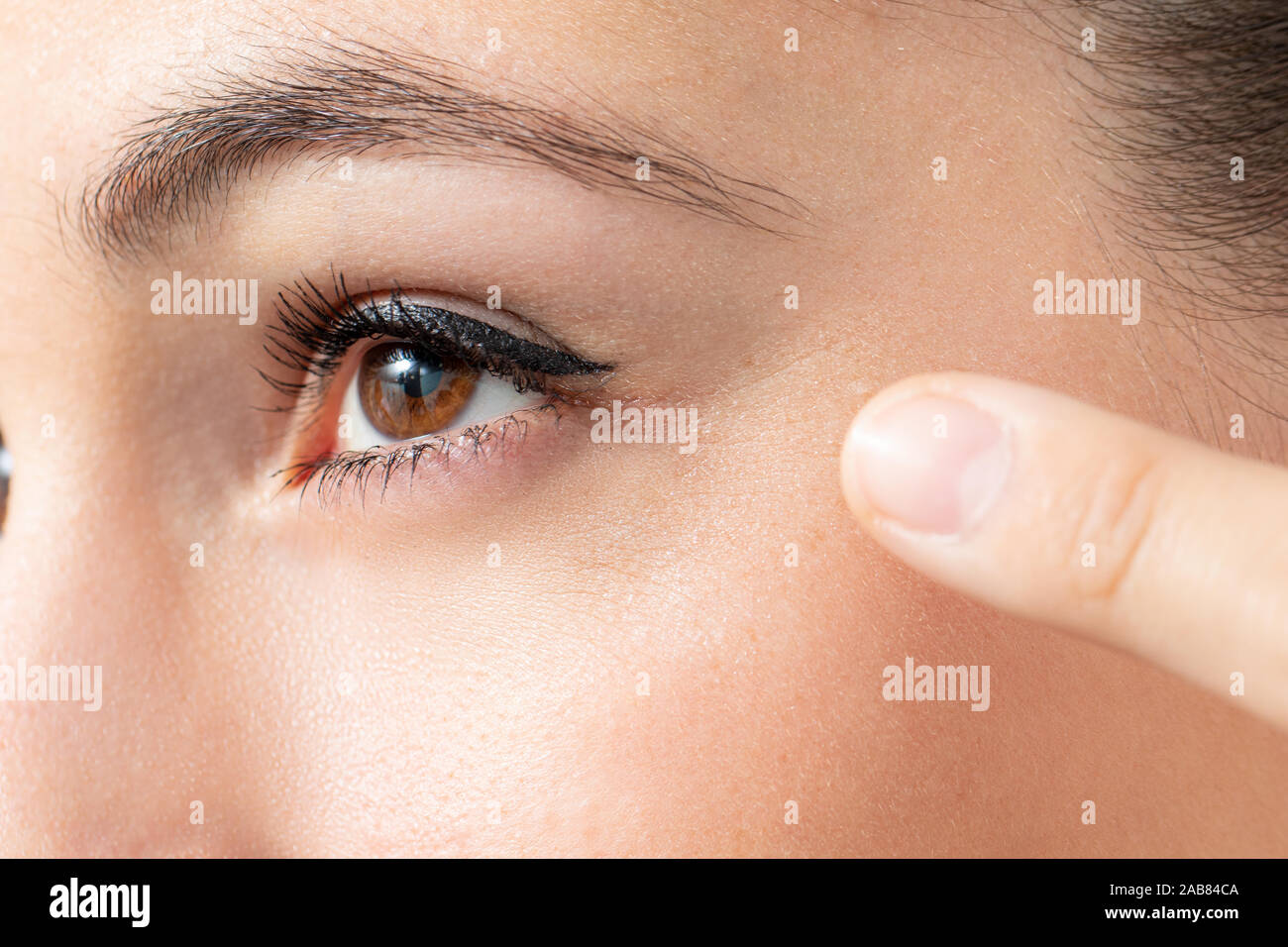 Extreme close up detail of finger pointing at wrinkles around eye on ...