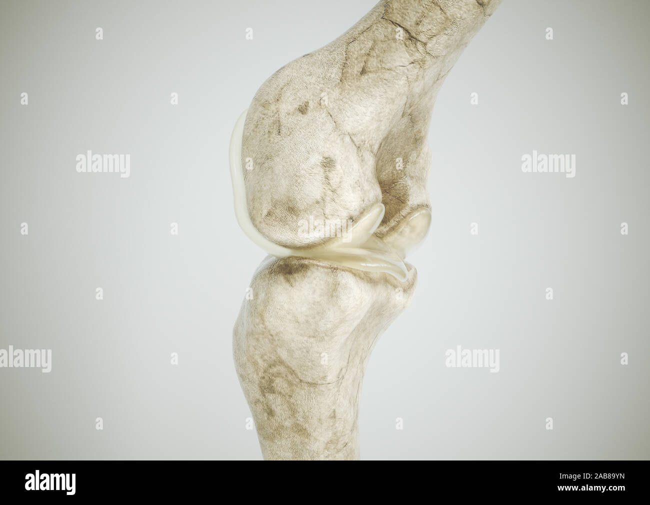 healthy knee without osteoarthritis - Position 3 - lateral - 3D ...