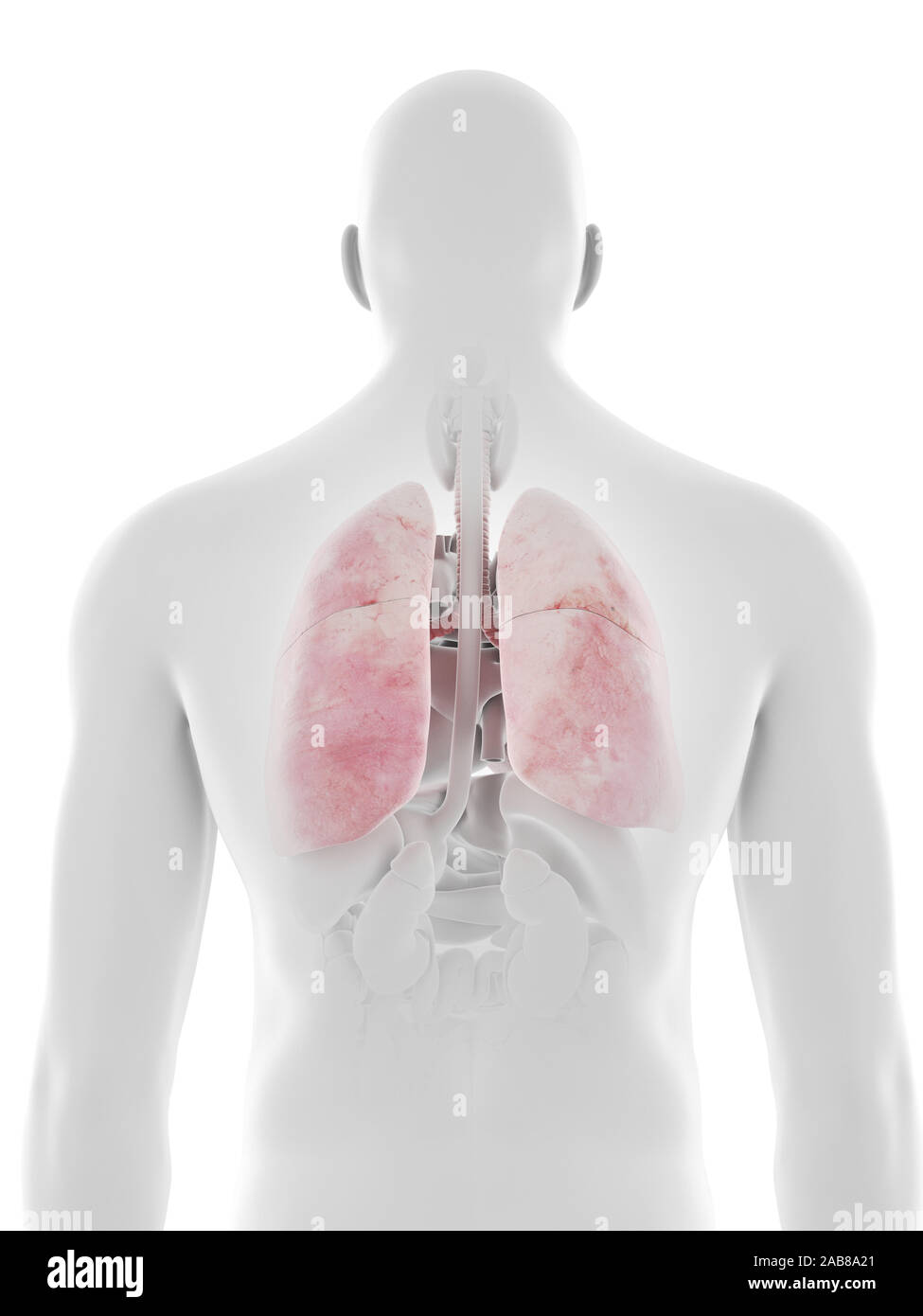 Cystic Fibrosis And Lungs High Resolution Stock Photography and Images - Alamy
