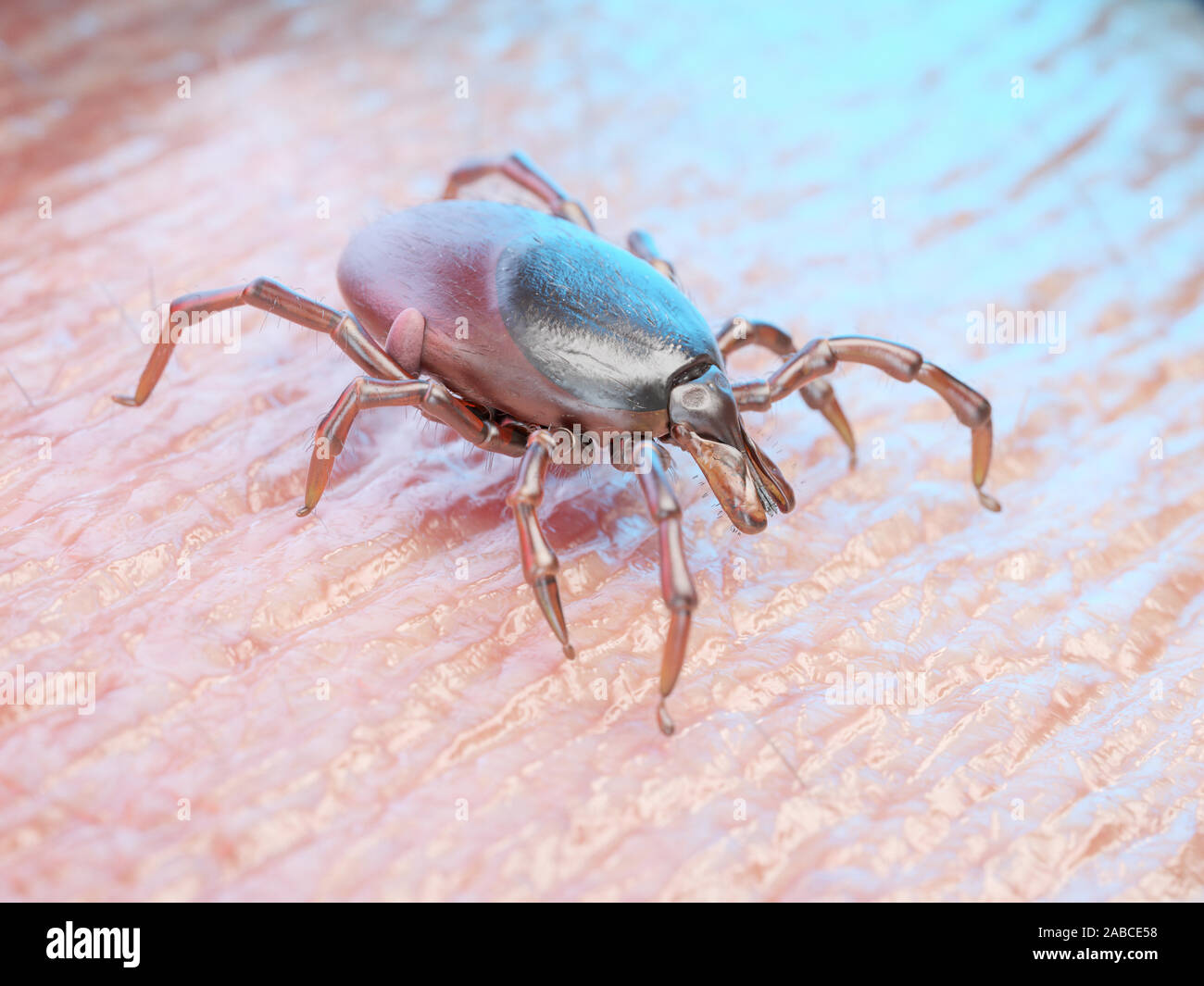 3d rendered medically accurate illustration of a tick on human skin ...