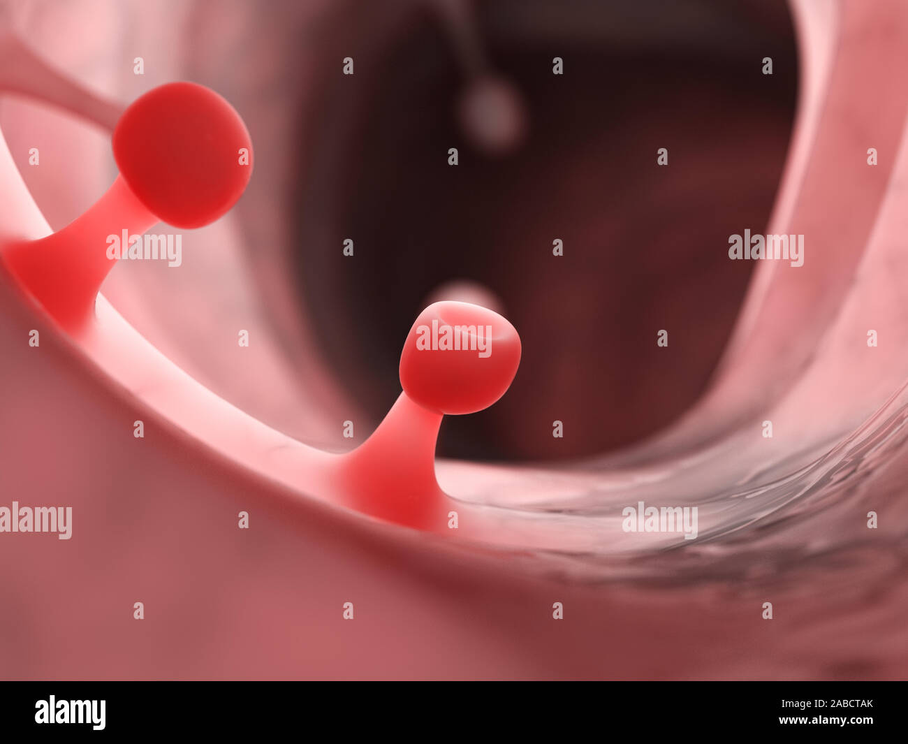 3d rendered medically accurate illustration of colon polyps Stock Photo ...