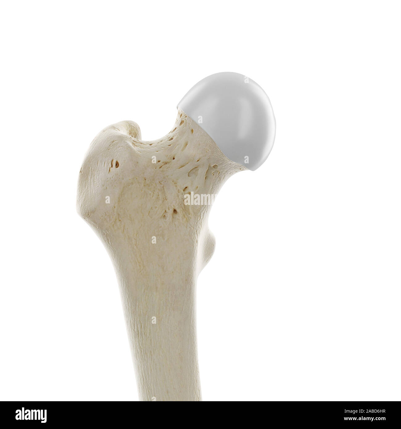 3d rendered medically accurate illustration of the upper femur joint ...