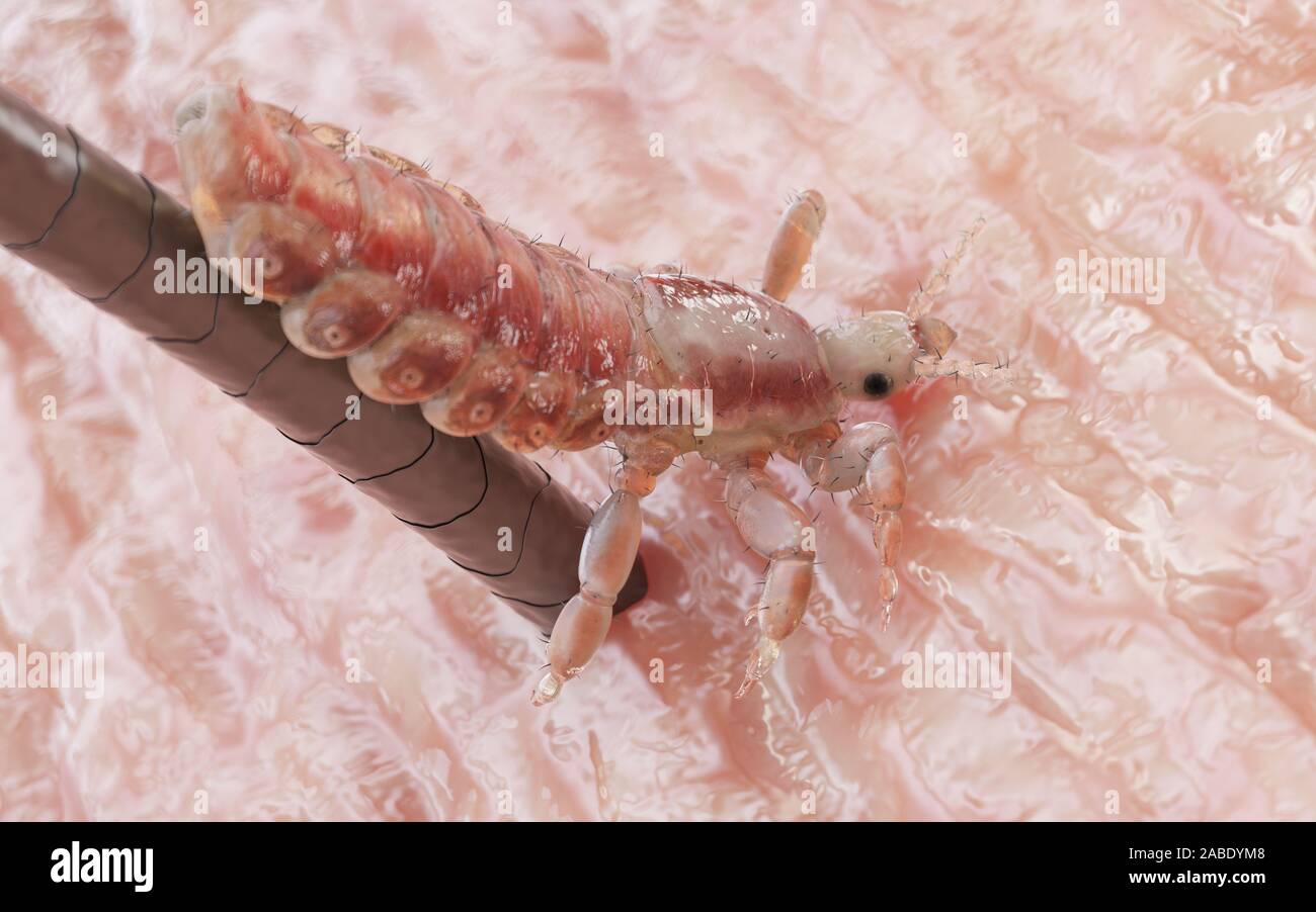 3d rendered medically accurate illustration of a head louse Stock Photo ...