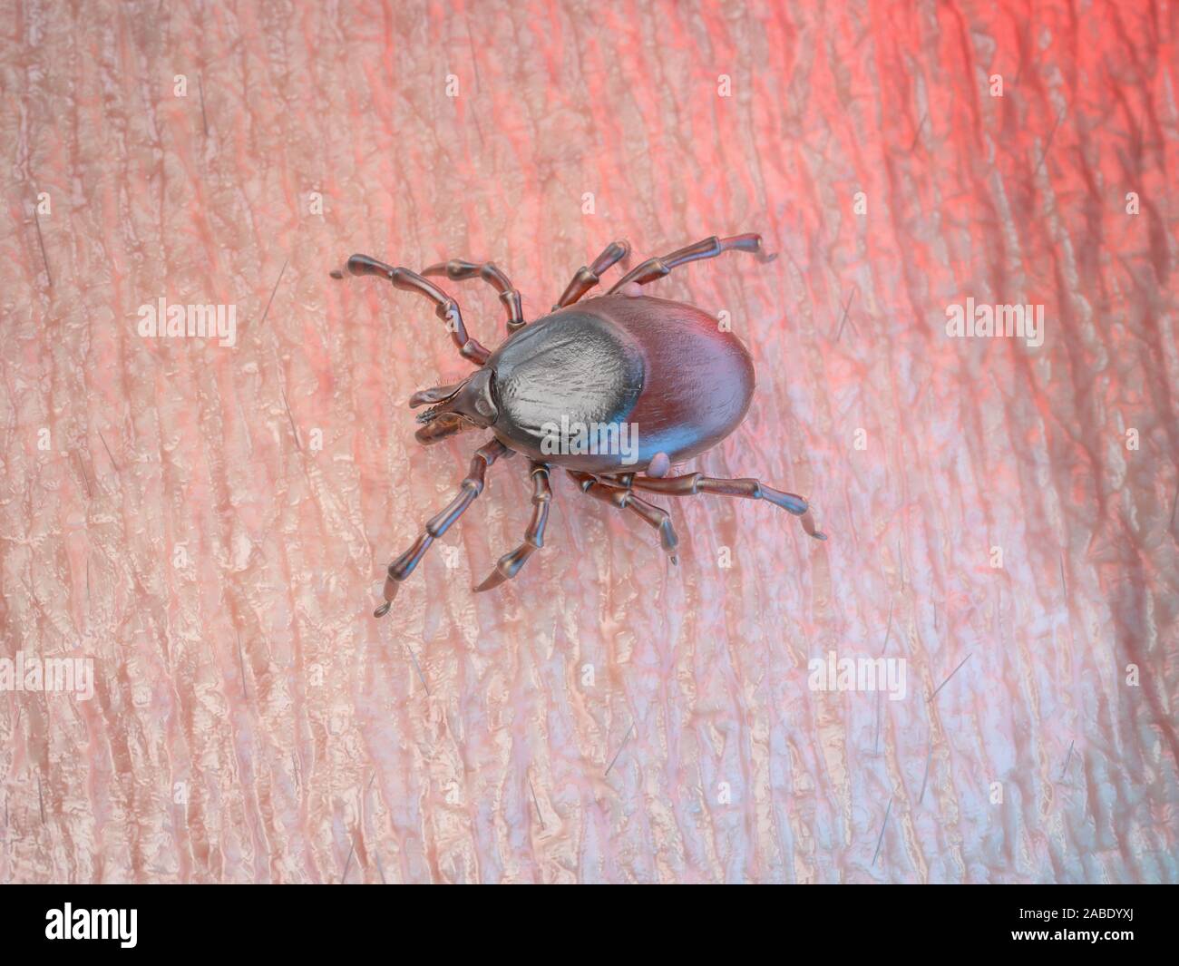 3d rendered medically accurate illustration of a tick on human skin ...