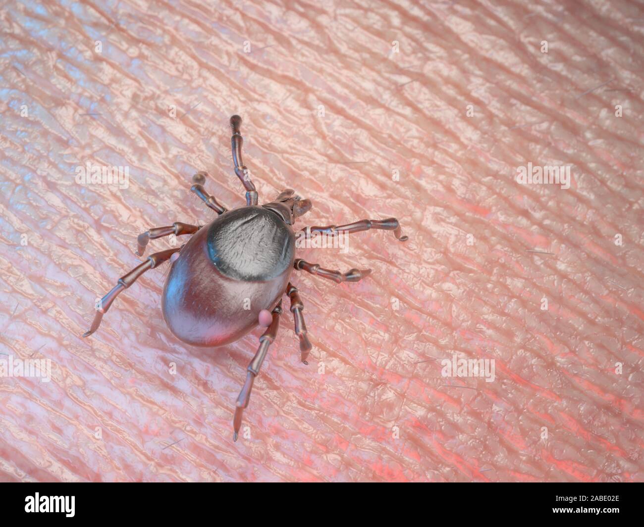 3d rendered medically accurate illustration of a tick on human skin ...