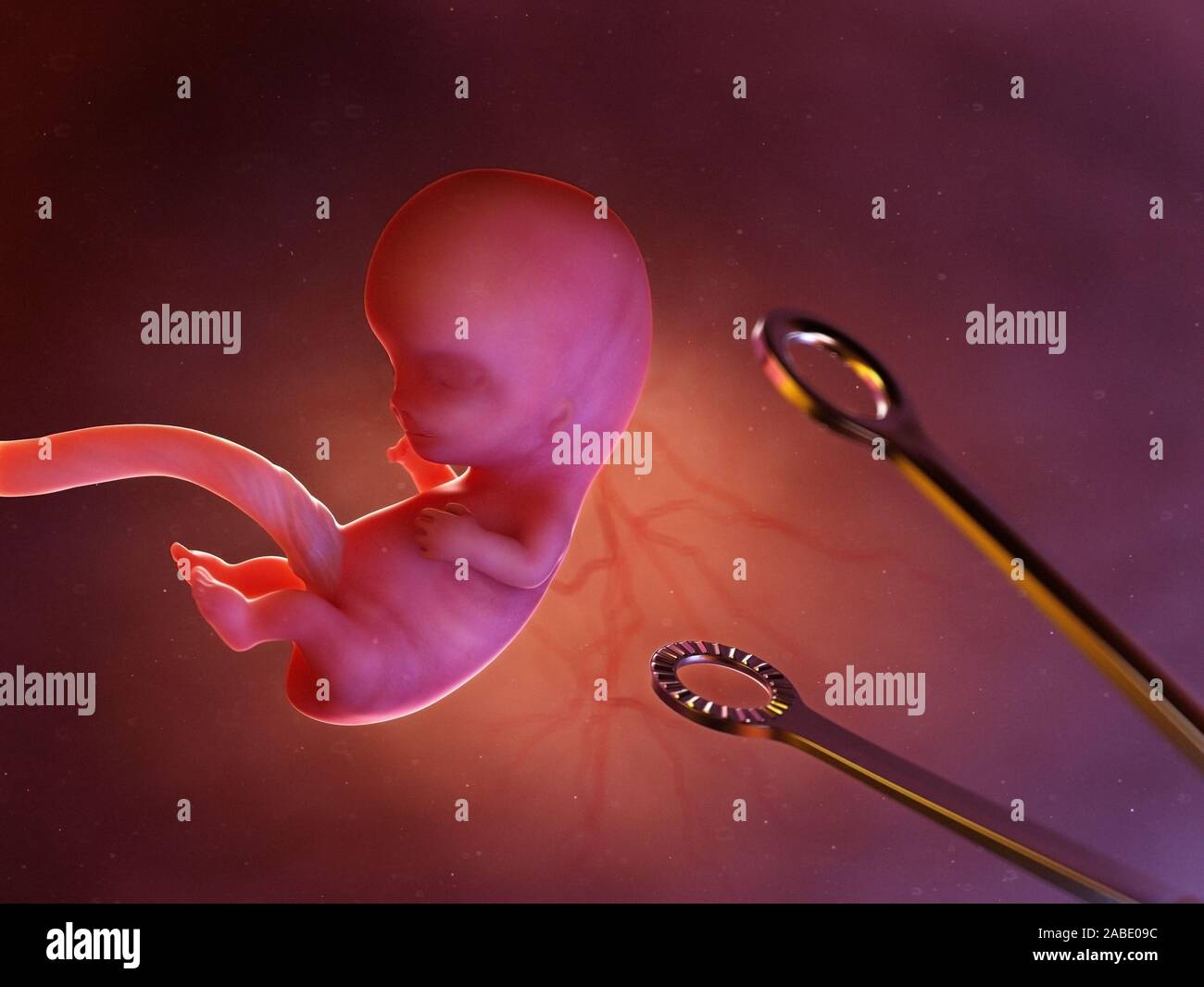 Baby Embryo Abortion