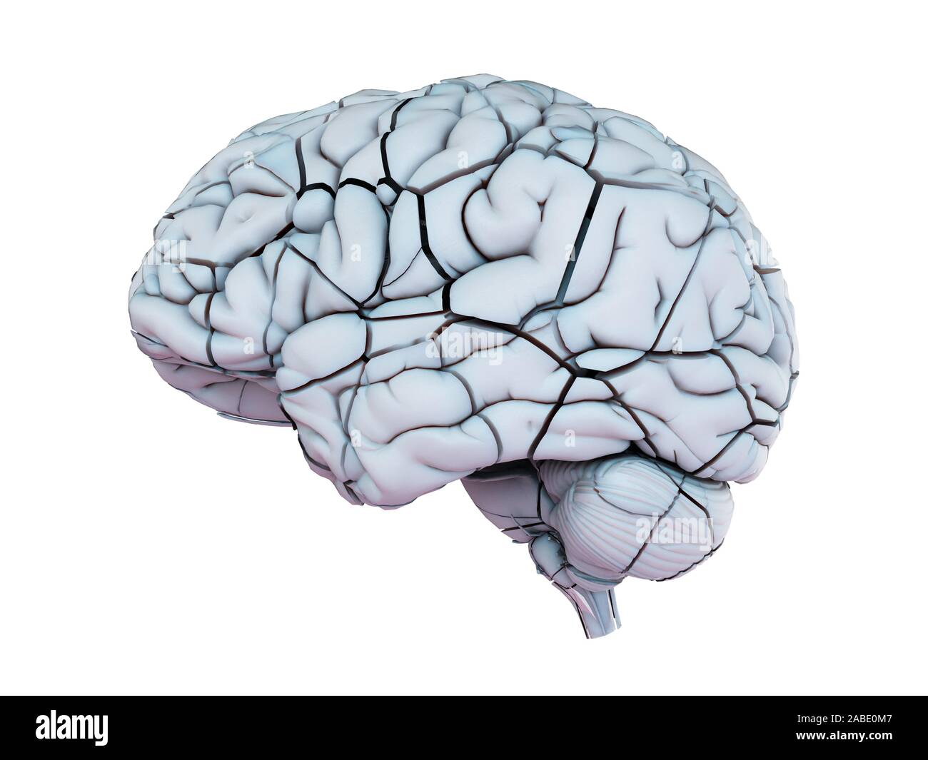 3d rendered medically accurate illustration of a broken human brain ...